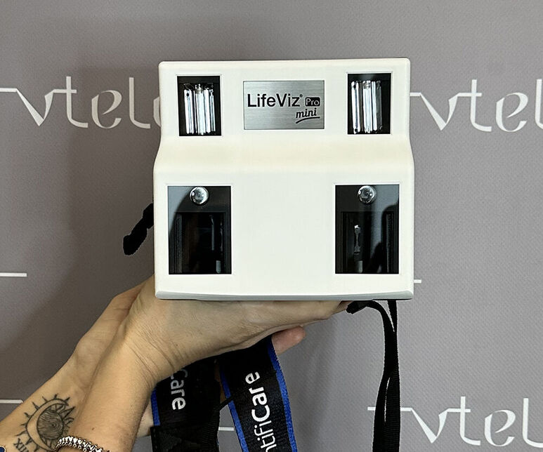 Что такое камера 3D LifeViz и какой результат дает при диагностике - Я ...